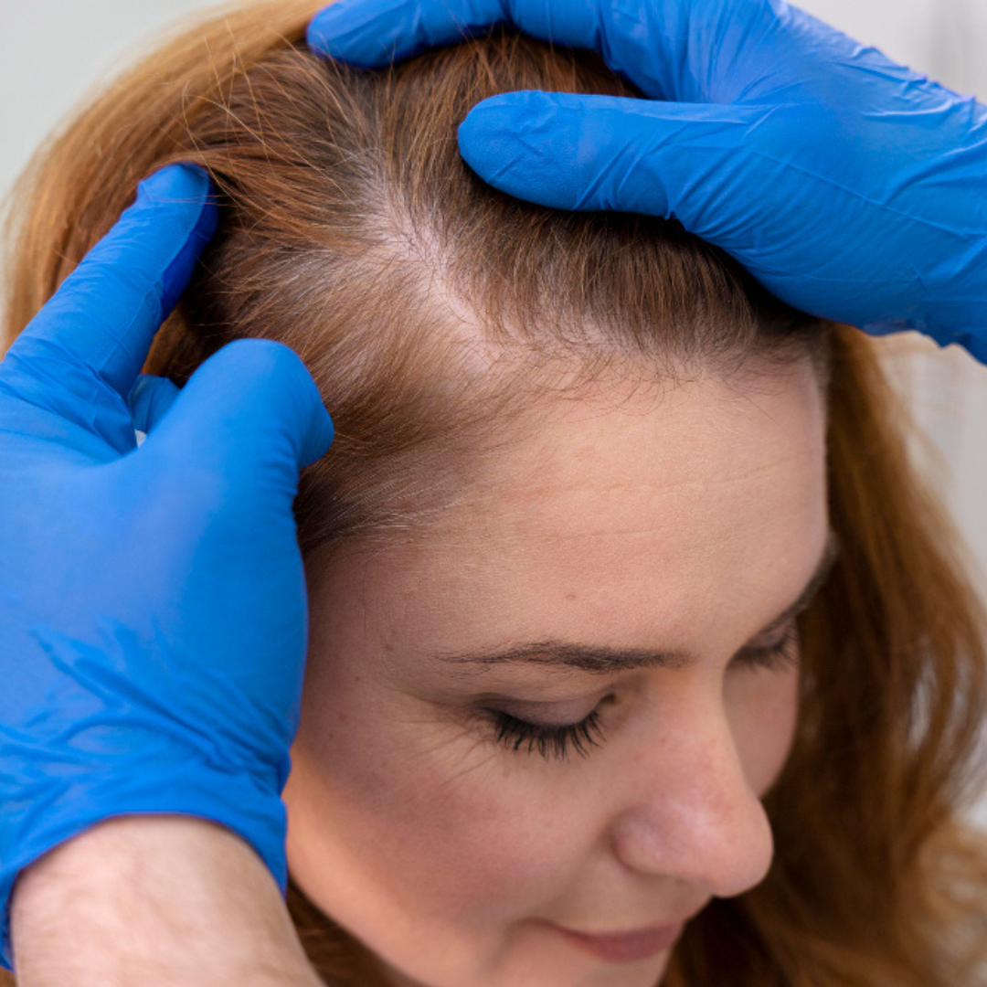 15 Proven Scalp Treatments to Supercharge Your Hair Growth In 2024 ...